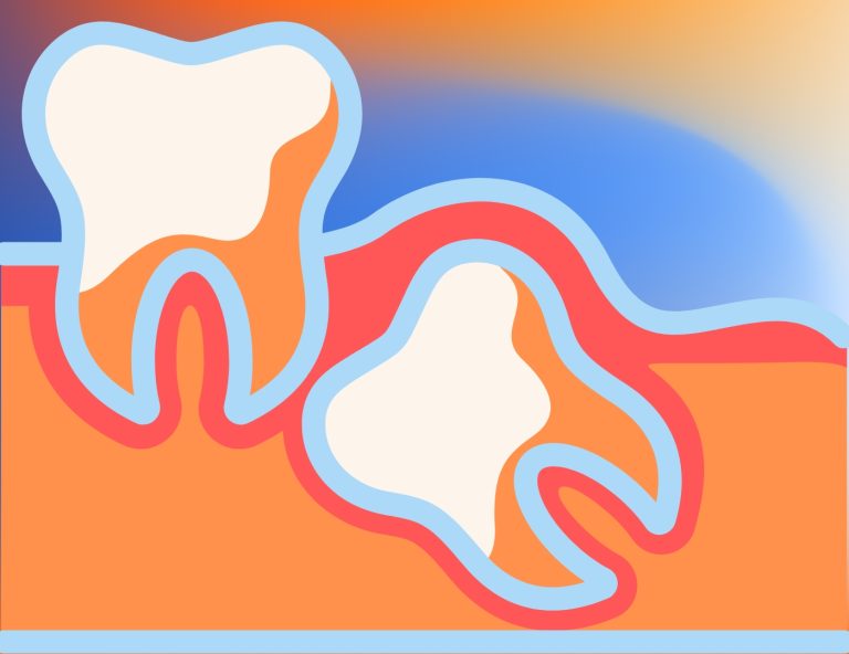 First Signs of Wisdom Teeth Coming In: What to Look Out For - Toronto ...