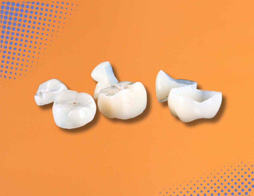 Tooth Cap vs Crown | difference between dental cap and crown - Toronto ...